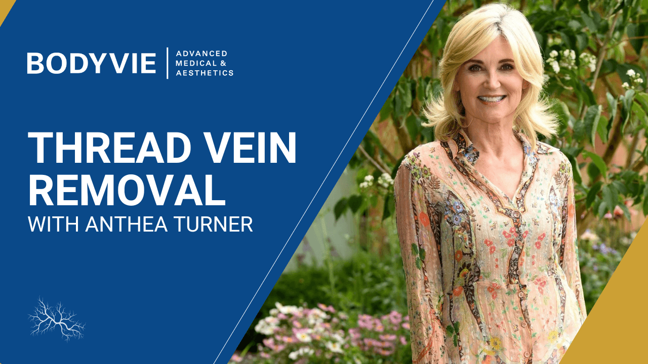 Thread Veins | Causes & Treatments