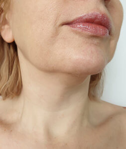 Jowls | Causes, Prevention & Treatment