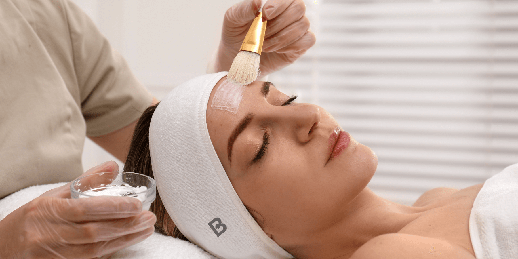PRX-T33 TCA Bio-Revitalisation in Richmond | Chemical Peel