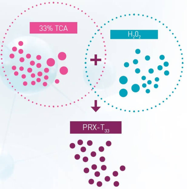 PRX-T33 TCA Bio-Revitalisation in Richmond | Chemical Peel