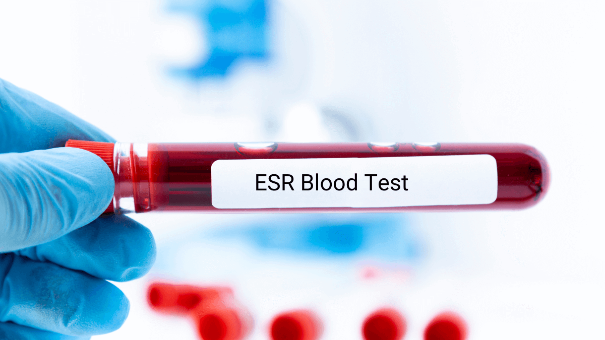 ESR Blood Test: What It Is and Why It Matters | Bodyvie